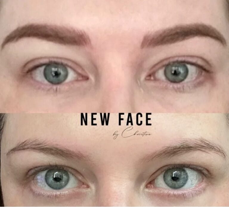 Eyebrow Tattoo Gone Wrong | The Ugly Side Of Eyebrow Tattooing